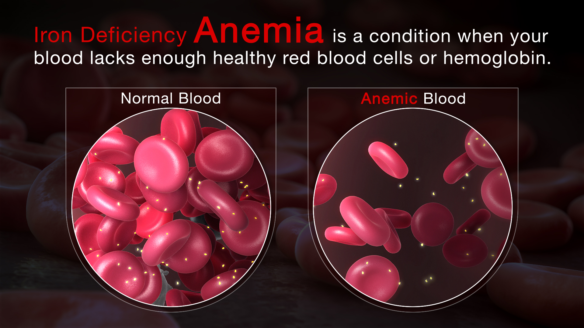 Iron Deficiency Anemia – SHAKLEE