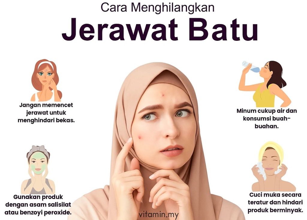 Jerawat Batu – Panduan Komprehensif Mengapa Ia Berlaku dan Strategi ...